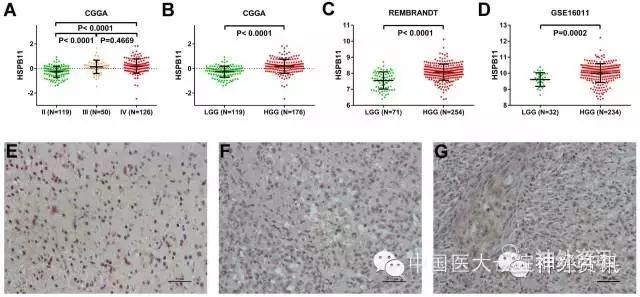 中国医科大学附属一院神经肿瘤研究团队证实局部微环境应激因素与胶质瘤患者预后相关 - 脑医汇