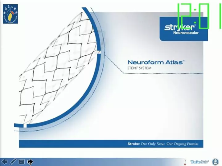 Adel Malek：Neuroform Atlas支架在颅内动脉瘤治疗中的应用丨OCIN2017精彩回顾 - 脑医汇