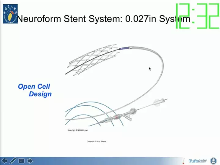 Adel Malek：Neuroform Atlas支架在颅内动脉瘤治疗中的应用丨OCIN2017精彩回顾 - 脑医汇