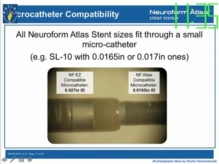 Adel Malek：Neuroform Atlas支架在颅内动脉瘤治疗中的应用丨OCIN2017精彩回顾 - 脑医汇