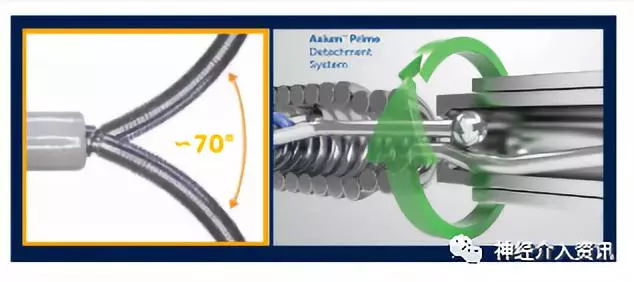 喻博教授：抗“琴弦效应”，超柔安全的Axium Prime ES弹簧圈 - 脑医汇