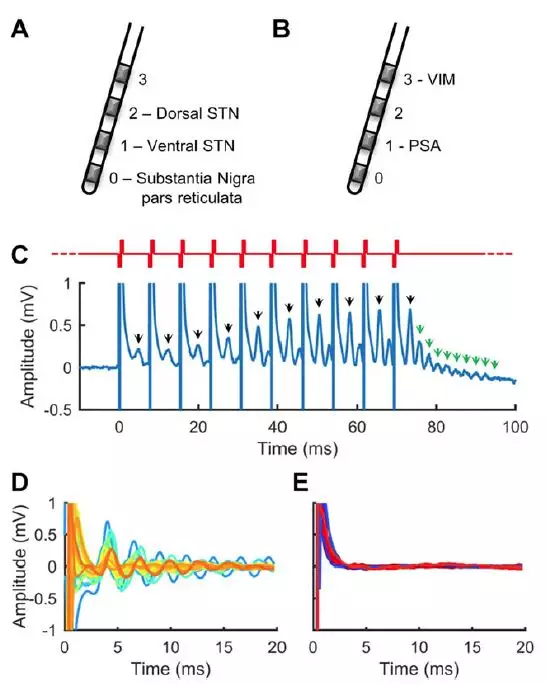 【景昱-神经科学专栏】| DBS诱发STN核团共振神经反应 - 脑医汇