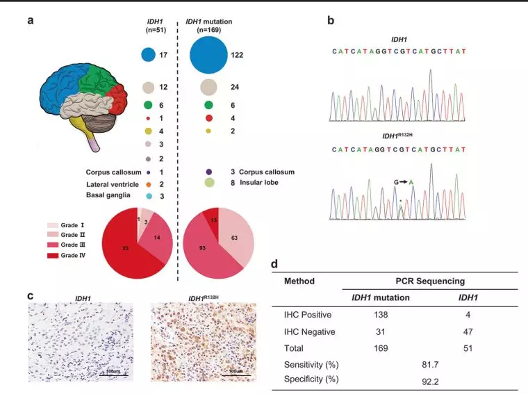 质谱法检测2-HG，快速诊断IDH突变 - 脑医汇