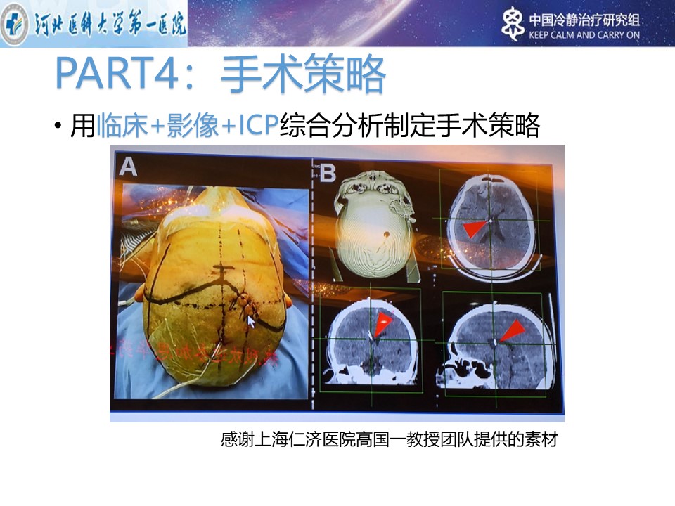 从神经重症的角度救治sTBI患者--sTBI患者的全流程管理理念 | 颅脑创伤-神经重症病例周刊（130期） - 脑医汇