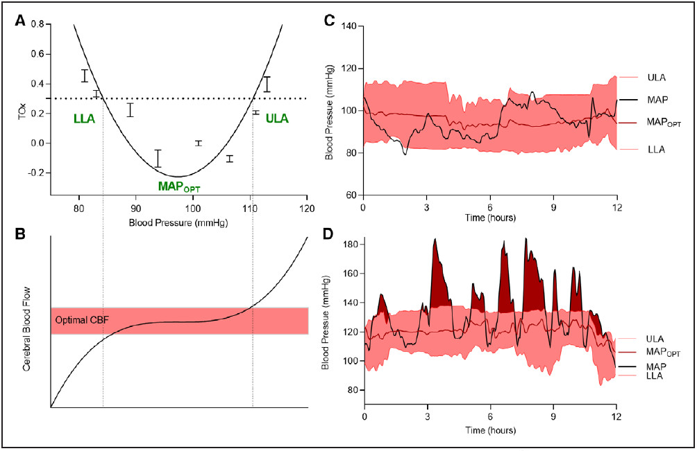 蛛网膜下腔出血后偏离个体化血压目标与预后不良相关 - 脑医汇