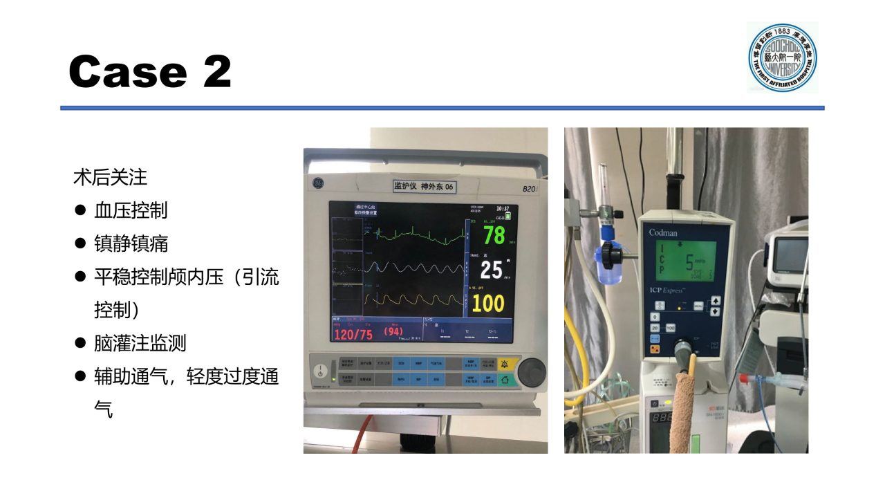 监测有道 | ICP监测在神经重症患者个体化差异治疗中的应用分享--【颅脑创伤-神经重症周刊】第164期 - 脑医汇 - 神外资讯 - 神介资讯