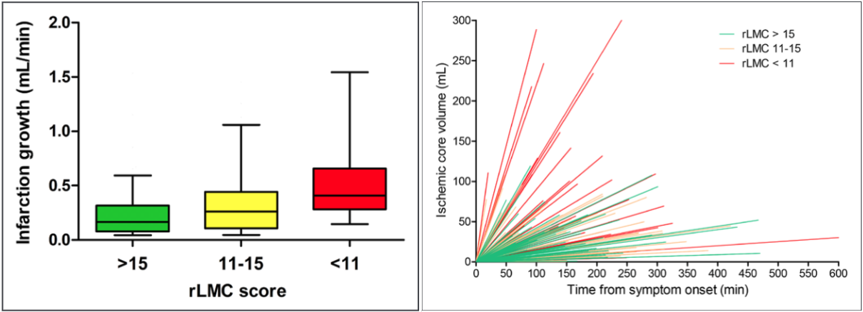 rLMC是评估大血管闭塞后超急性期脑梗死扩大的指标 - 脑医汇