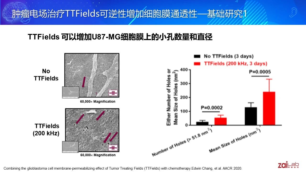 薛晓英教授：TTFields与细胞膜通透性—AACR II 新进展 - 脑医汇