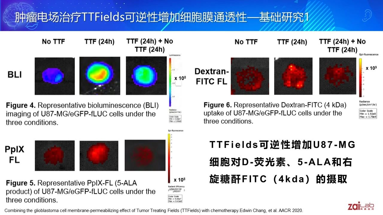薛晓英教授：TTFields与细胞膜通透性—AACR II 新进展 - 脑医汇