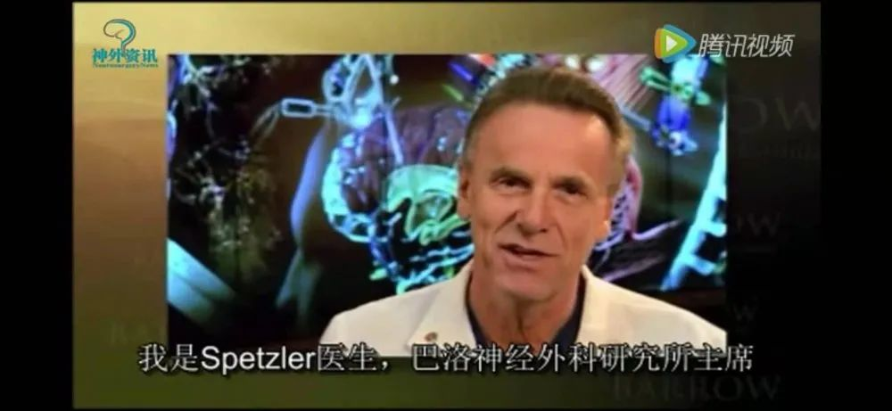 【11月13日晚20:00双语直播】听大师讲故事——Spetzler教授：我的神经外科之旅，国际神经外科教育与培训系列网课 - 脑医汇