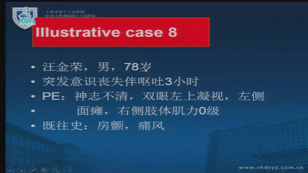 张全斌：Solitaire FR在AIS血管内治疗中的技巧与困难丨第七届全国介入医学工程大会精彩回顾 - 脑医汇