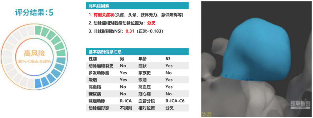 智疗卒中先锋医生，AI科技赋能医疗——苏大一附院 李波教授 - 脑医汇