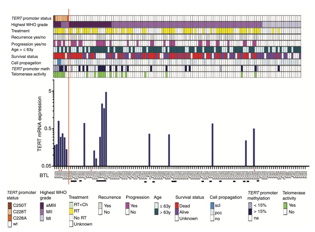 TERTp突变在脑膜瘤中的研究进展 - 脑医汇