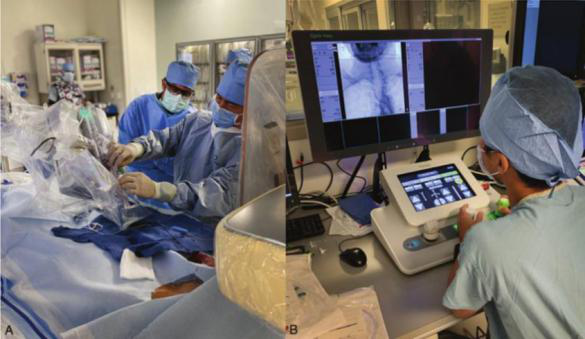 机器人系统在神经介入领域的应用 - 脑医汇