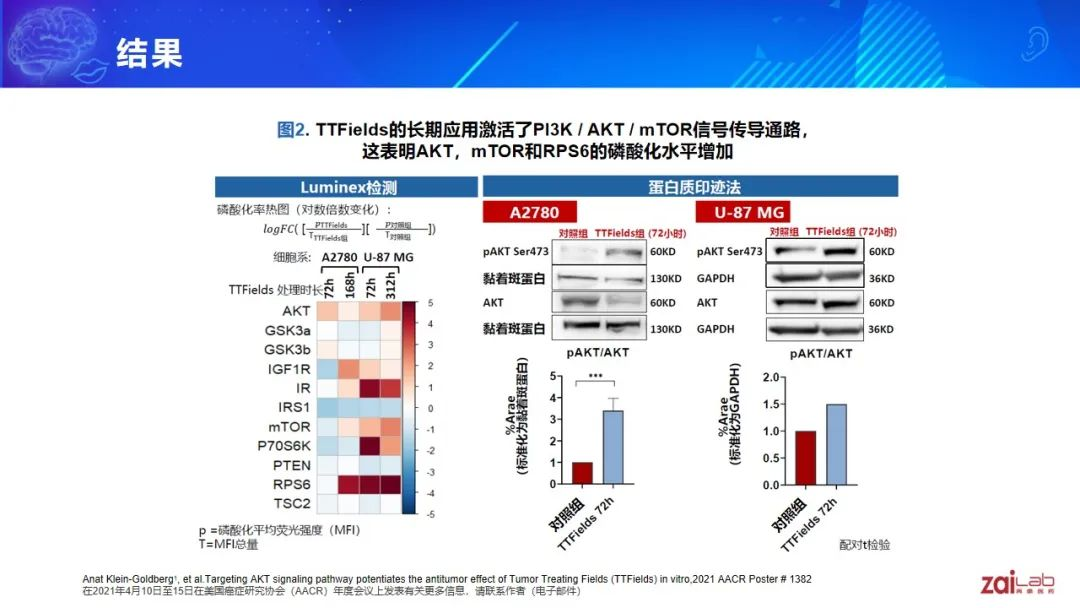 郭琤琤教授：2021 AACR TTFields-update（二） - 脑医汇