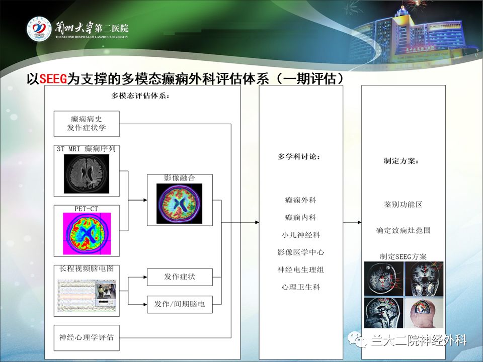 基于SEEG的多模态评估体系在FCD继发难治性癫痫中的应用 - 脑医汇