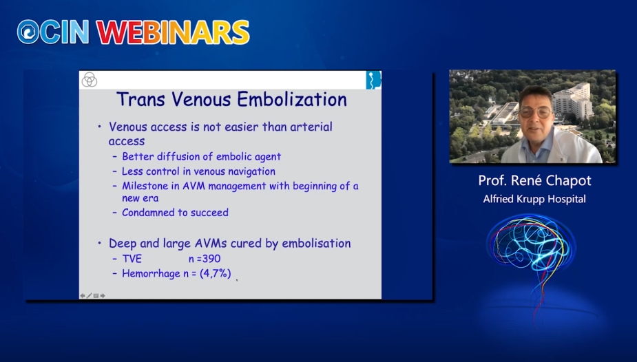 OCIN WEBINARS第六期回顾 | 脑动静脉畸形的治愈性栓塞：经静脉还是经动脉？