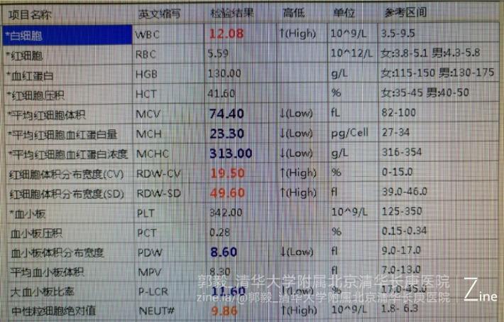 丘脑出血微创穿刺治疗 - 脑医汇